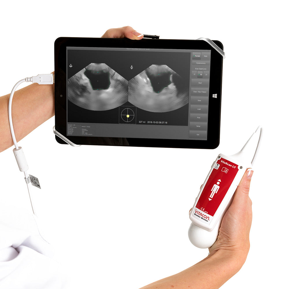 VitaScan v.2 Bladder Scanner System (incl. Transducer, Tablet ...